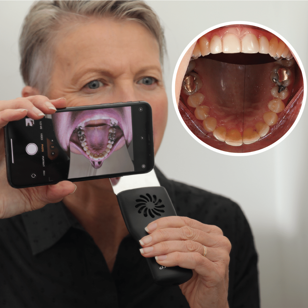 d.Mistify Data Capture Kit – EOCA