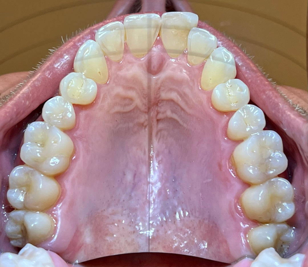 d.Mistify Pro Data Capture Kit – EOCA