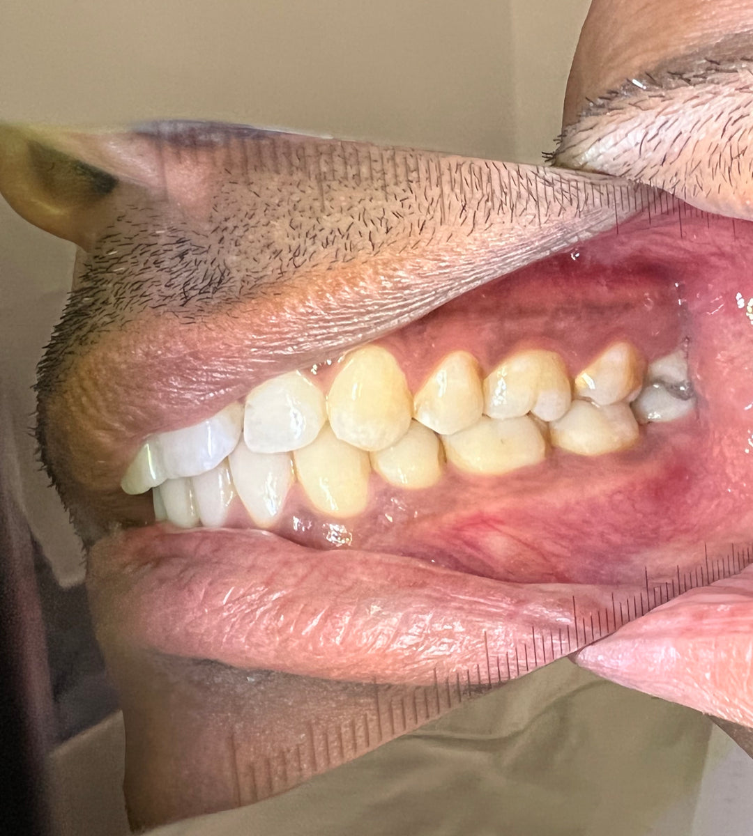 d.Mistify Pro Data Capture Kit – EOCA