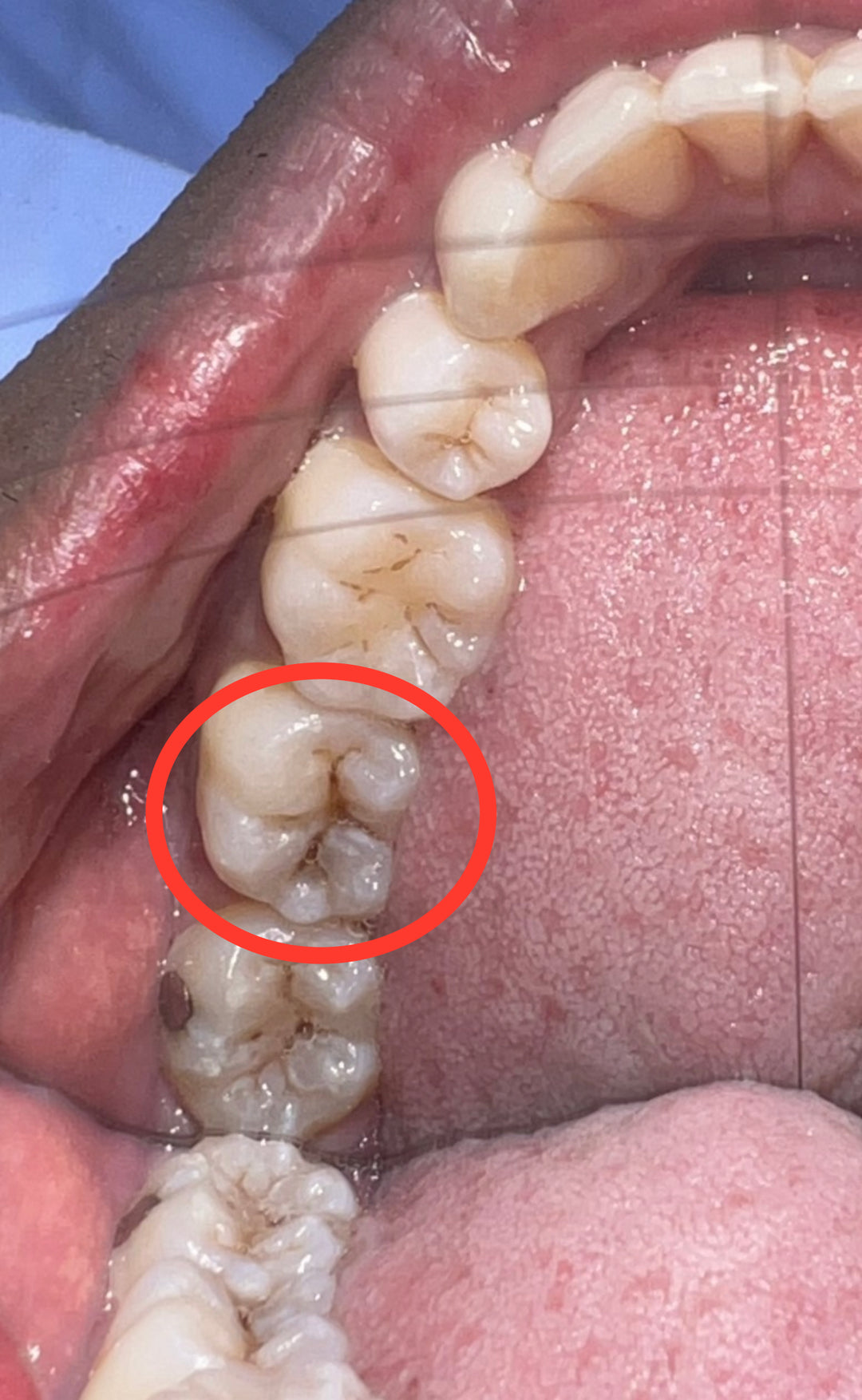 d.Mistify Pro Data Capture Kit – EOCA