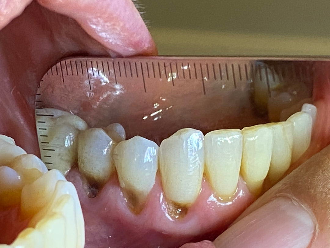 d.Mistify Pro Data Capture Kit – EOCA