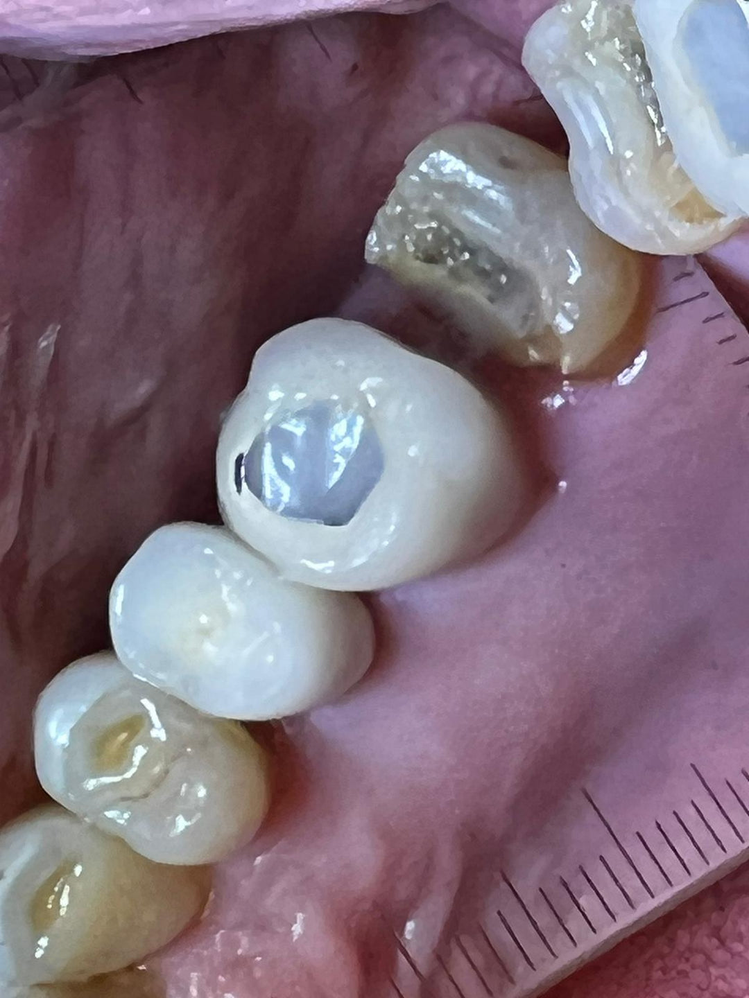 d.Mistify Pro Data Capture Kit – EOCA